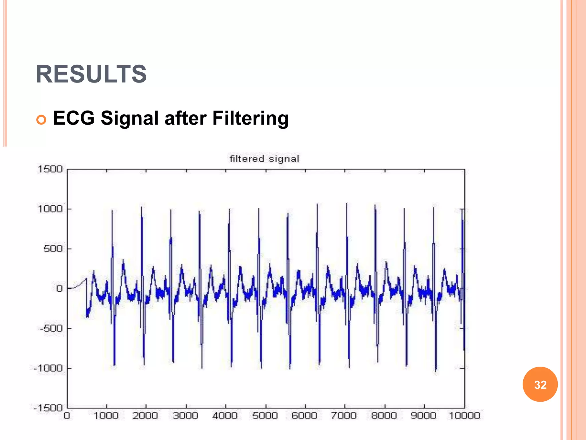 Ecg Beat Classification And Feature Extraction Using Artificial Neural