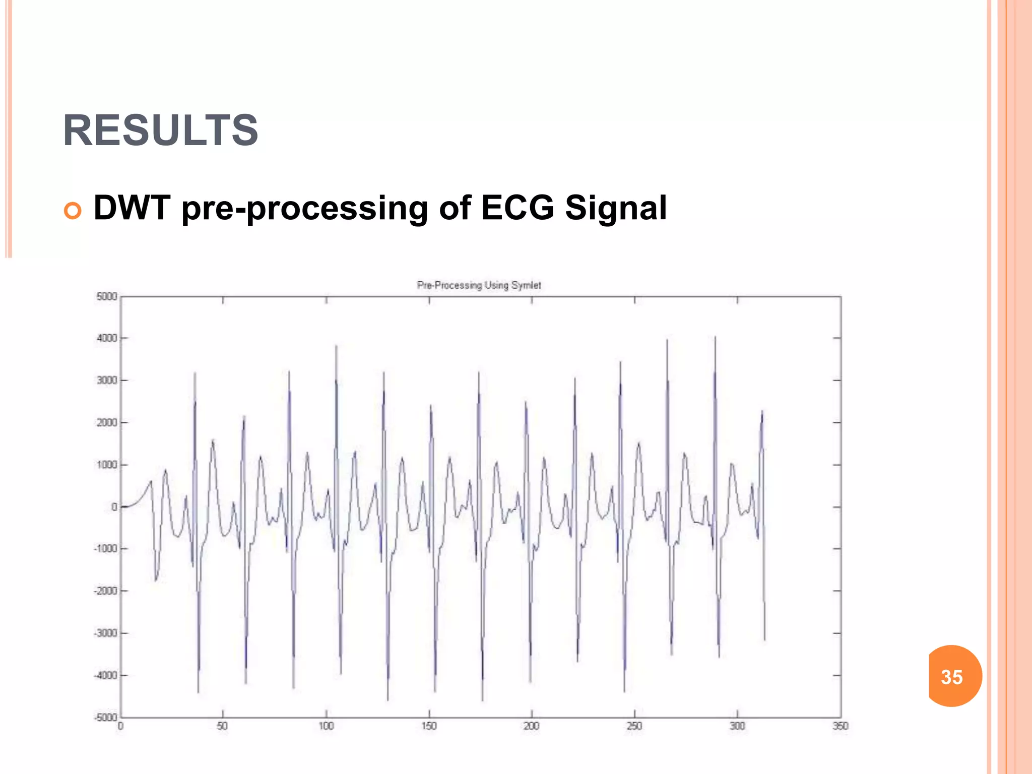 Ecg Beat Classification And Feature Extraction Using Artificial Neural