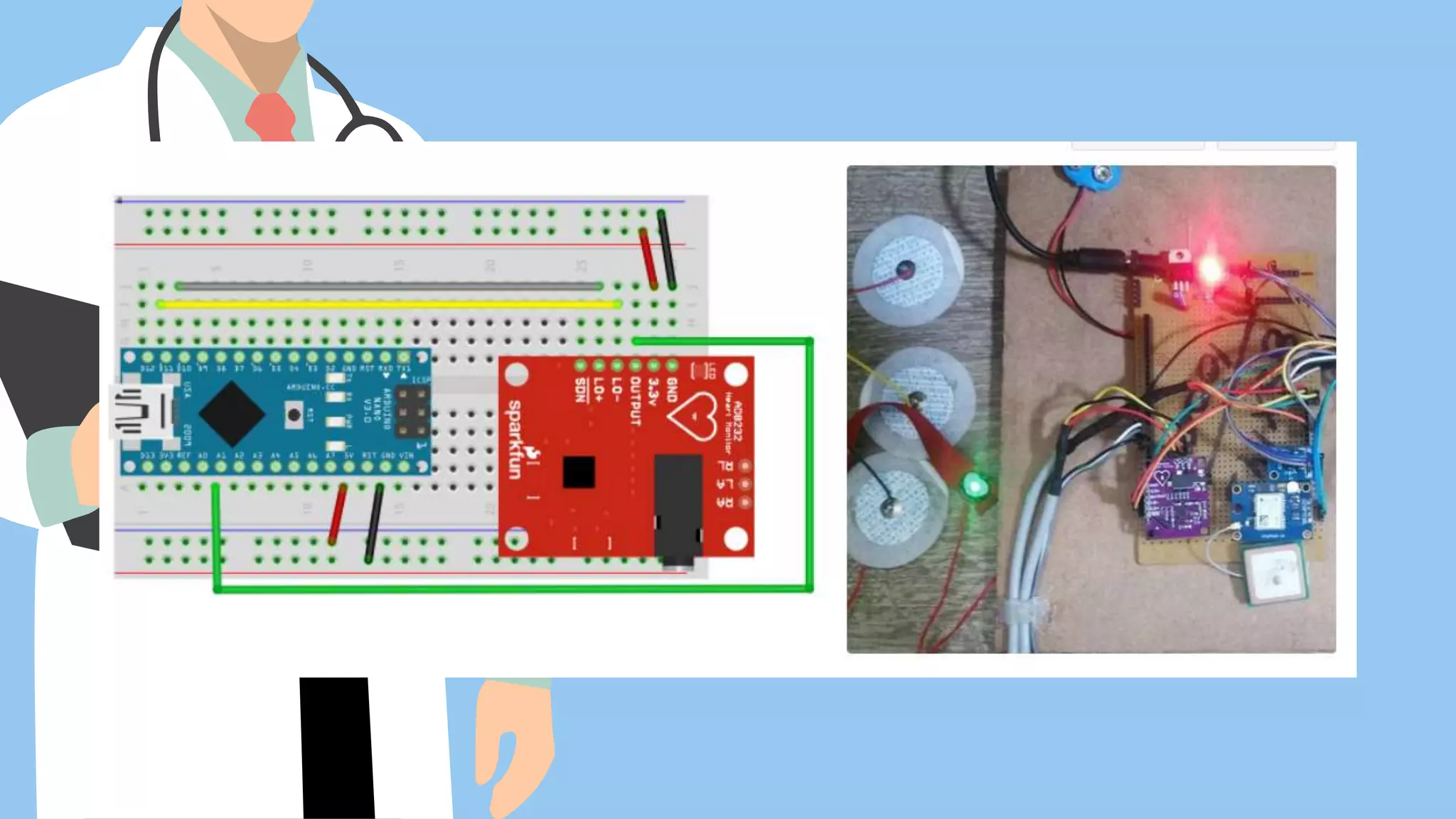 Ecg Berbasis Arduino Ppt