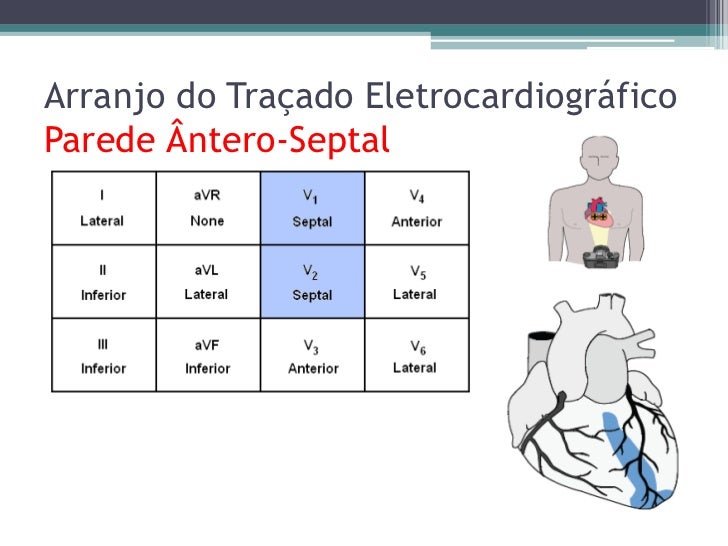Ecg básico