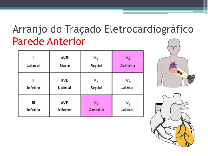 Ecg básico
