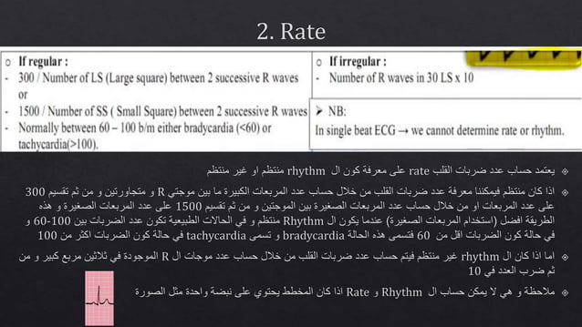 Ecg by ali faris | PPT