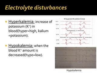 Electrocardiogram | PPT