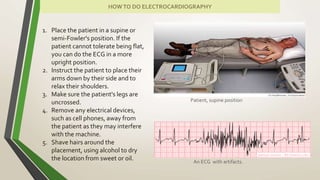 Ecg by Ns Nining | PPTX