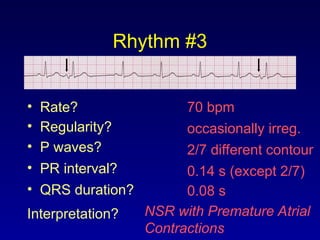 Comprehensive ECG Basics and Cardiac Rhythm Interpretation Course | PPT