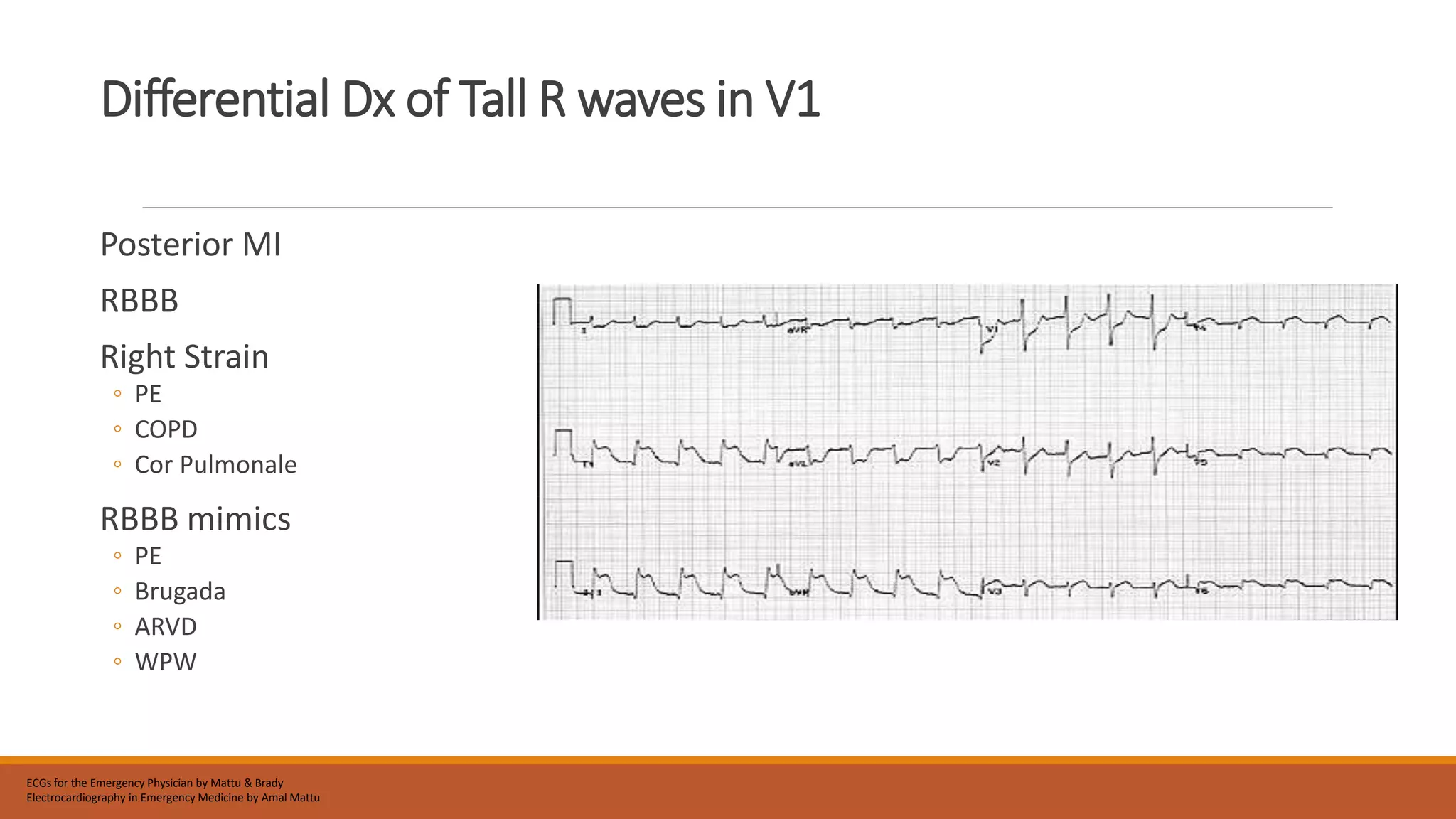 ECG Cap cuu (1).pptx