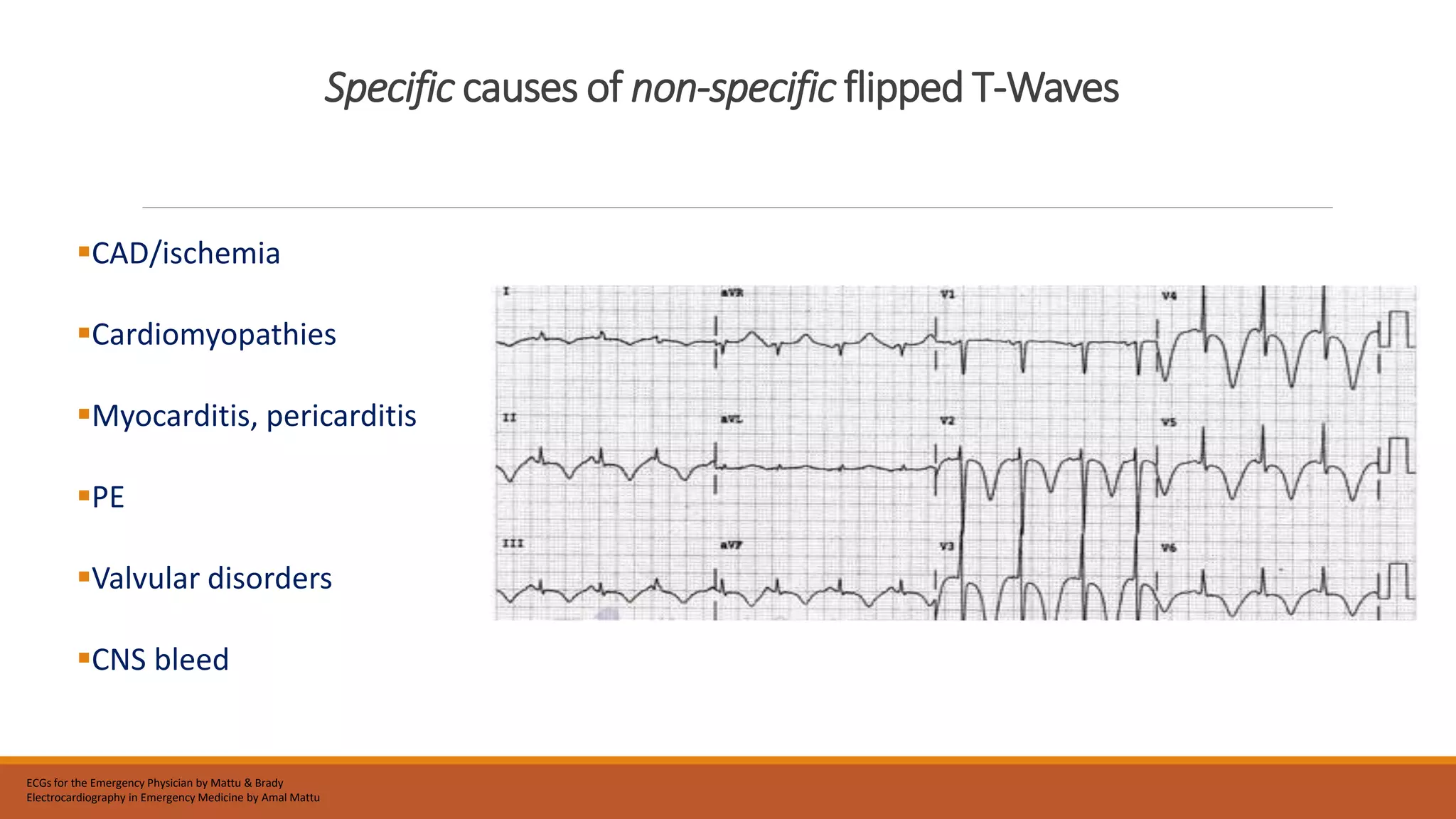 ECG Cap cuu (1).pptx