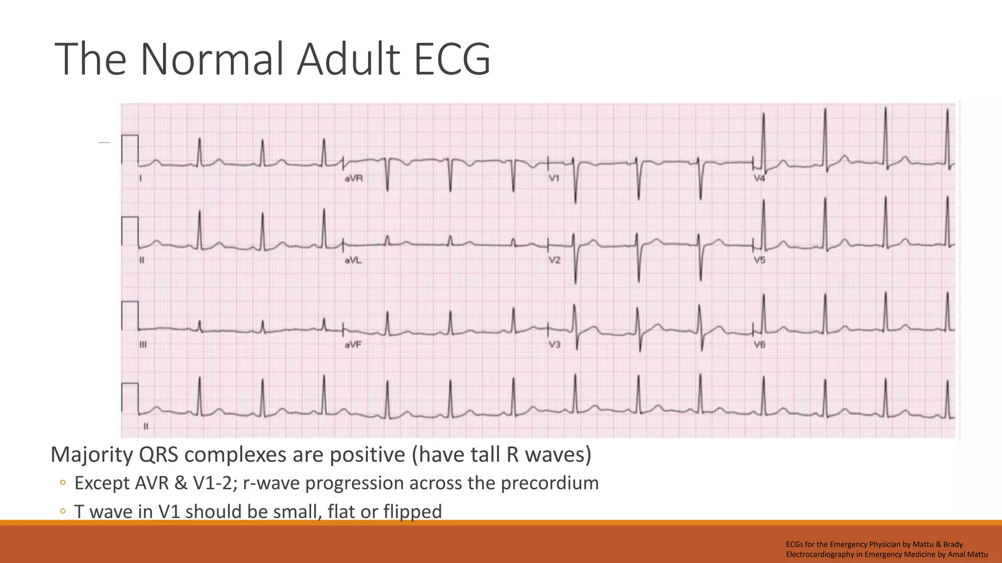 ECG Cap cuu (1).pptx