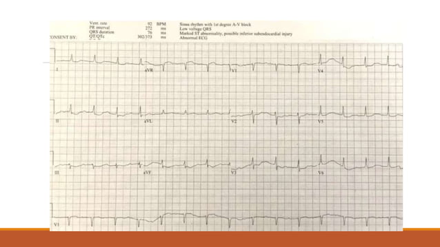 ECG Cap cuu (1).pptx