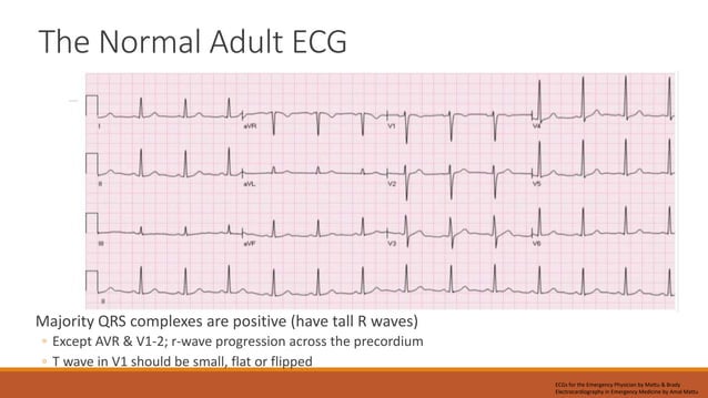 ECG Cap cuu (1).pptx