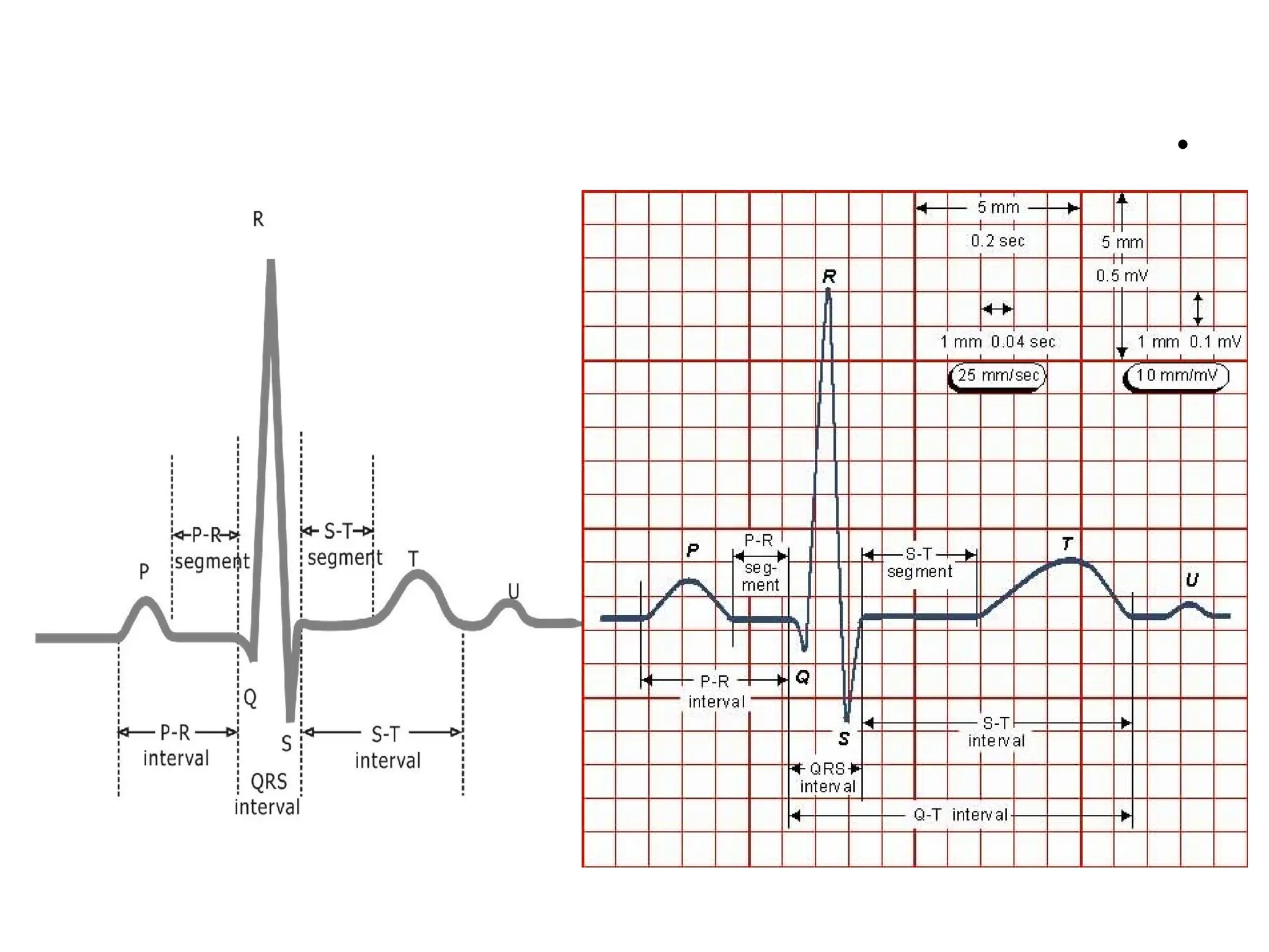 Basic of ECG & Cardiac monitoring for Health Professionals.pptx