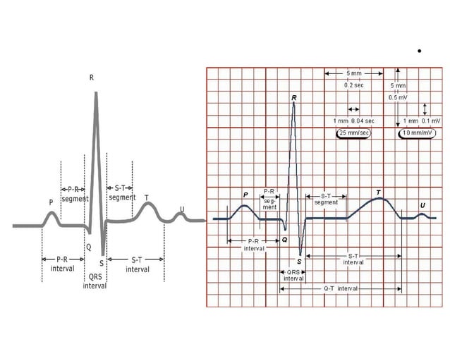 Basic of ECG & Cardiac monitoring for Health Professionals.pptx