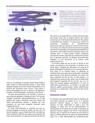 Ecg castellanos rayado. | PDF