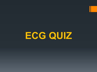 ECG CHALLENGE | PPTX