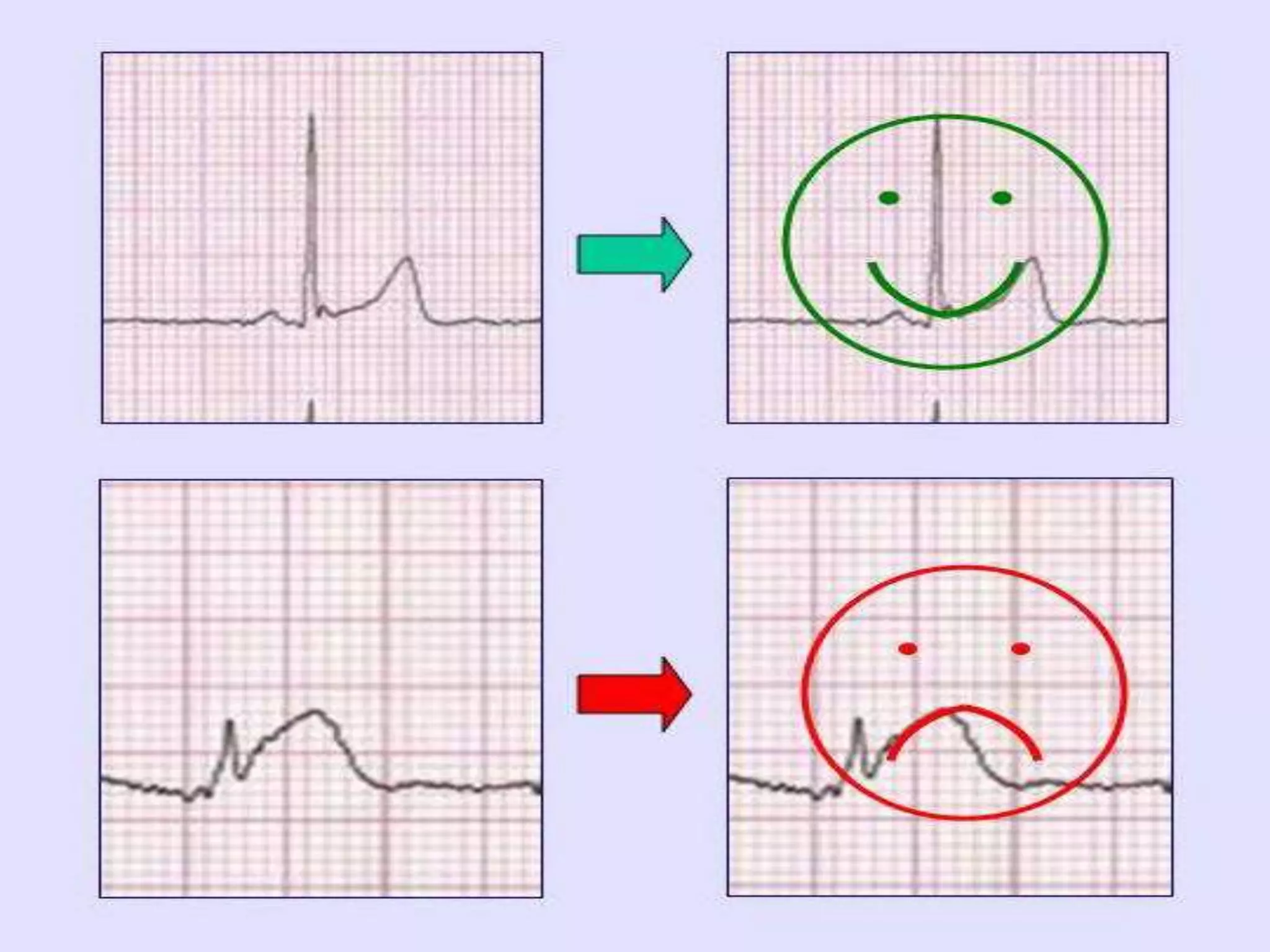Ecg challenges | PPT