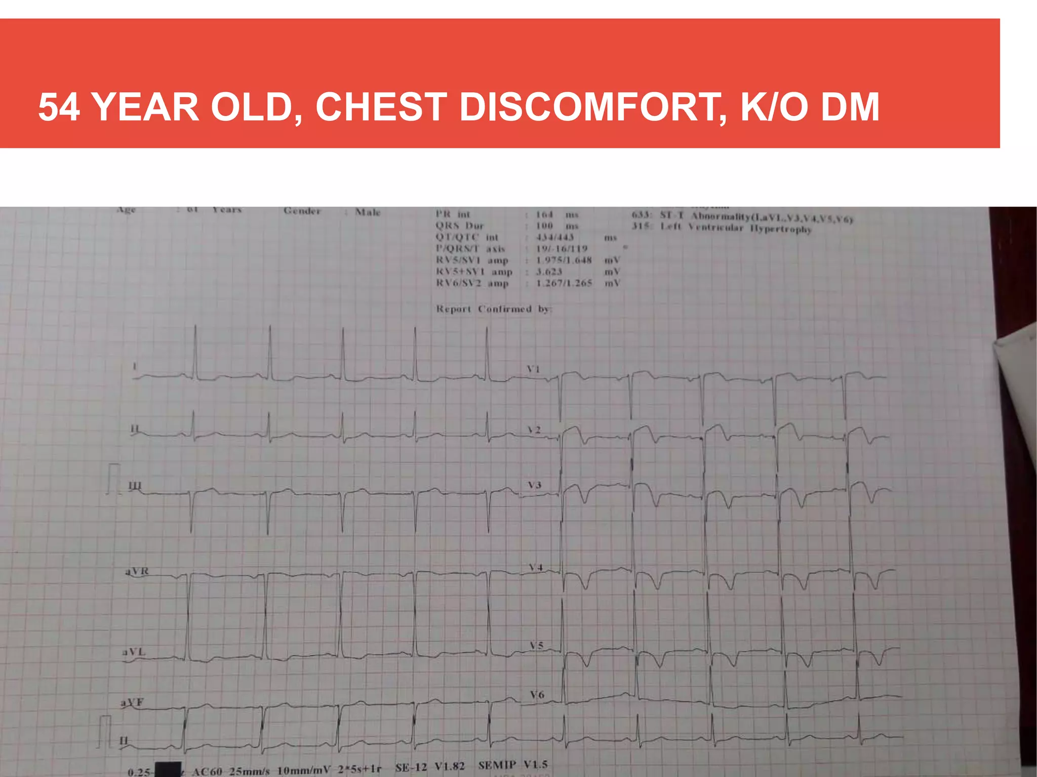 Ecg challenges | PPT