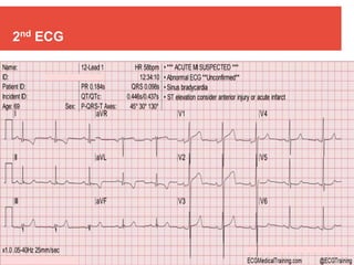Ecg challenges | PPT