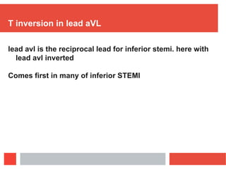 Ecg challenges | PPT