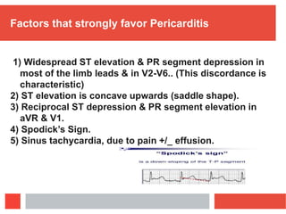 Ecg challenges | PPTX