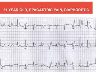 Ecg challenges | PPTX