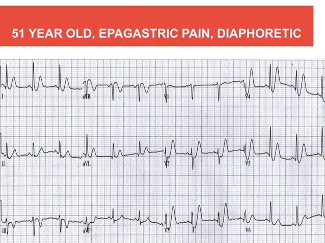 Ecg challenges | PPT