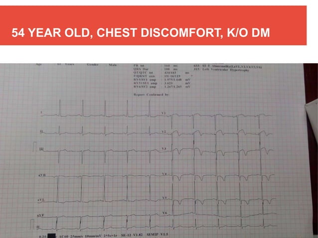 Ecg challenges | PPT