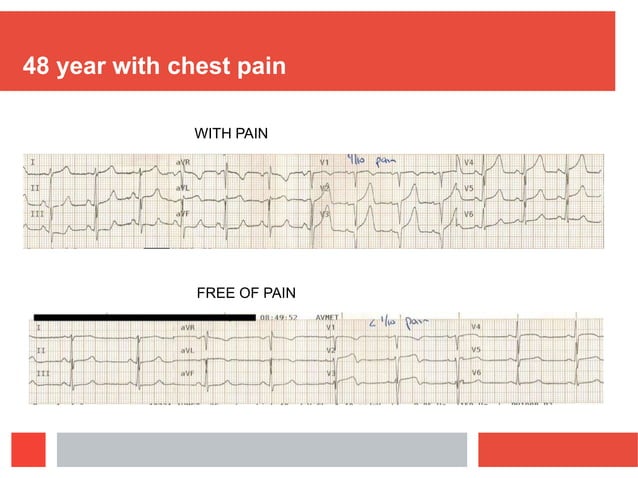 Ecg challenges | PPT