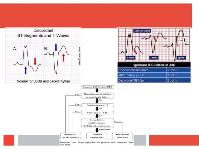 Ecg challenges | PPT