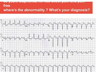 Ecg challenges | PPT