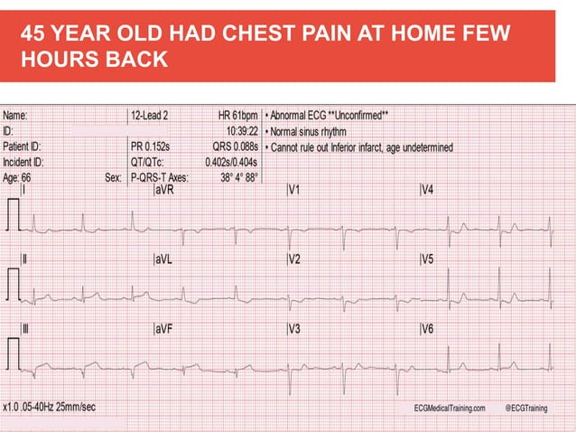 Ecg challenges | PPT