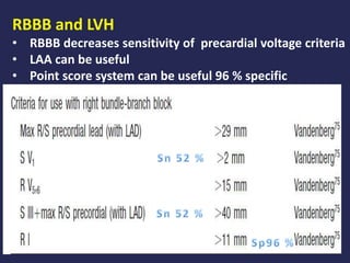 ECG diagnosis of chamber enlargement | PPTX