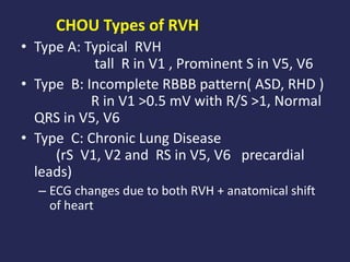 ECG diagnosis of chamber enlargement | PPTX