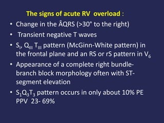 ECG diagnosis of chamber enlargement | PPTX