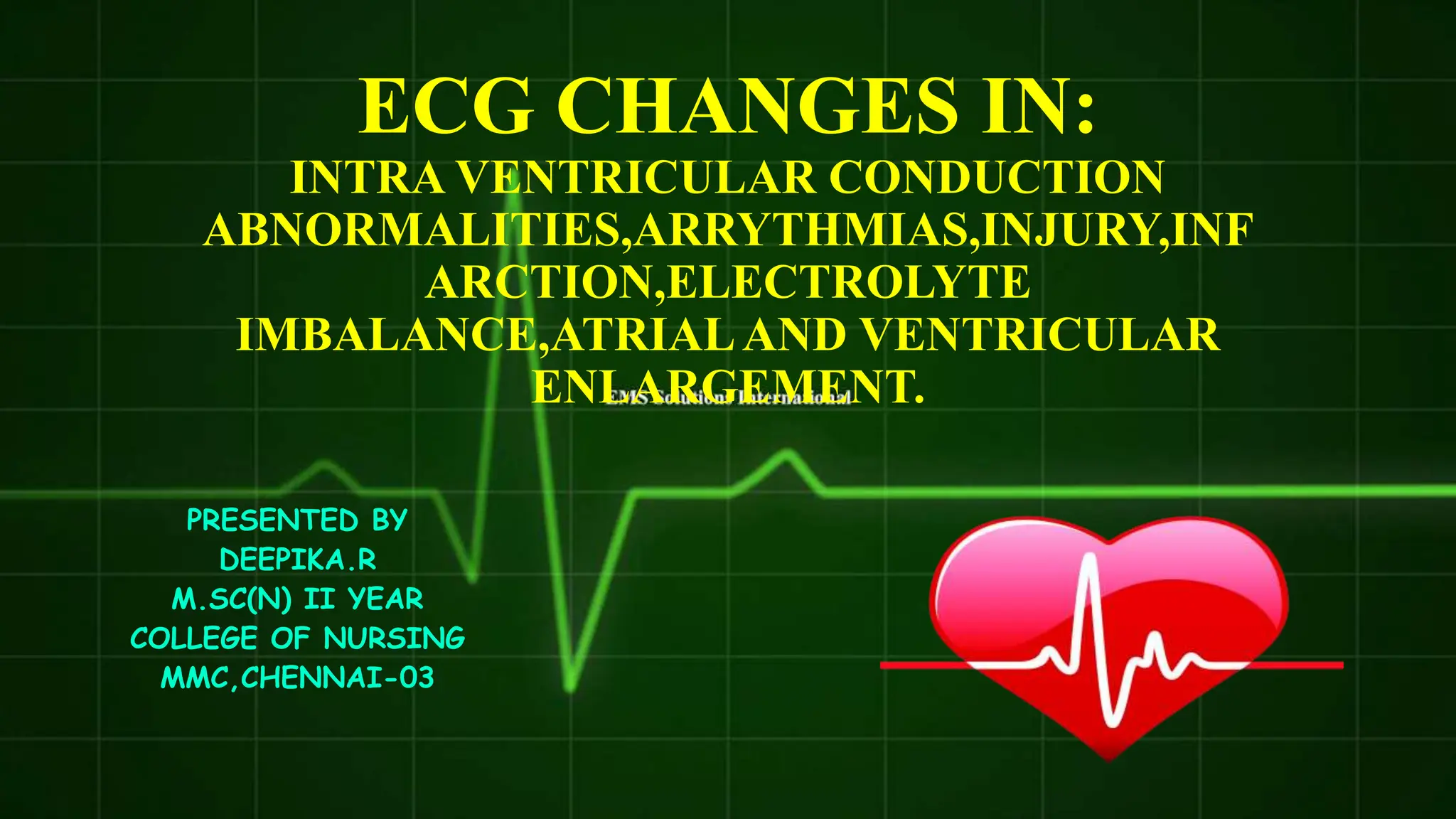 ECG changes, changes in intraventricular conduction | PPT