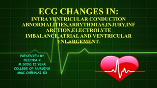 ECG changes, changes in intraventricular conduction | PPT
