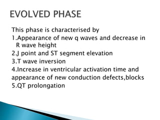 Ecg changes in mi | PPTX