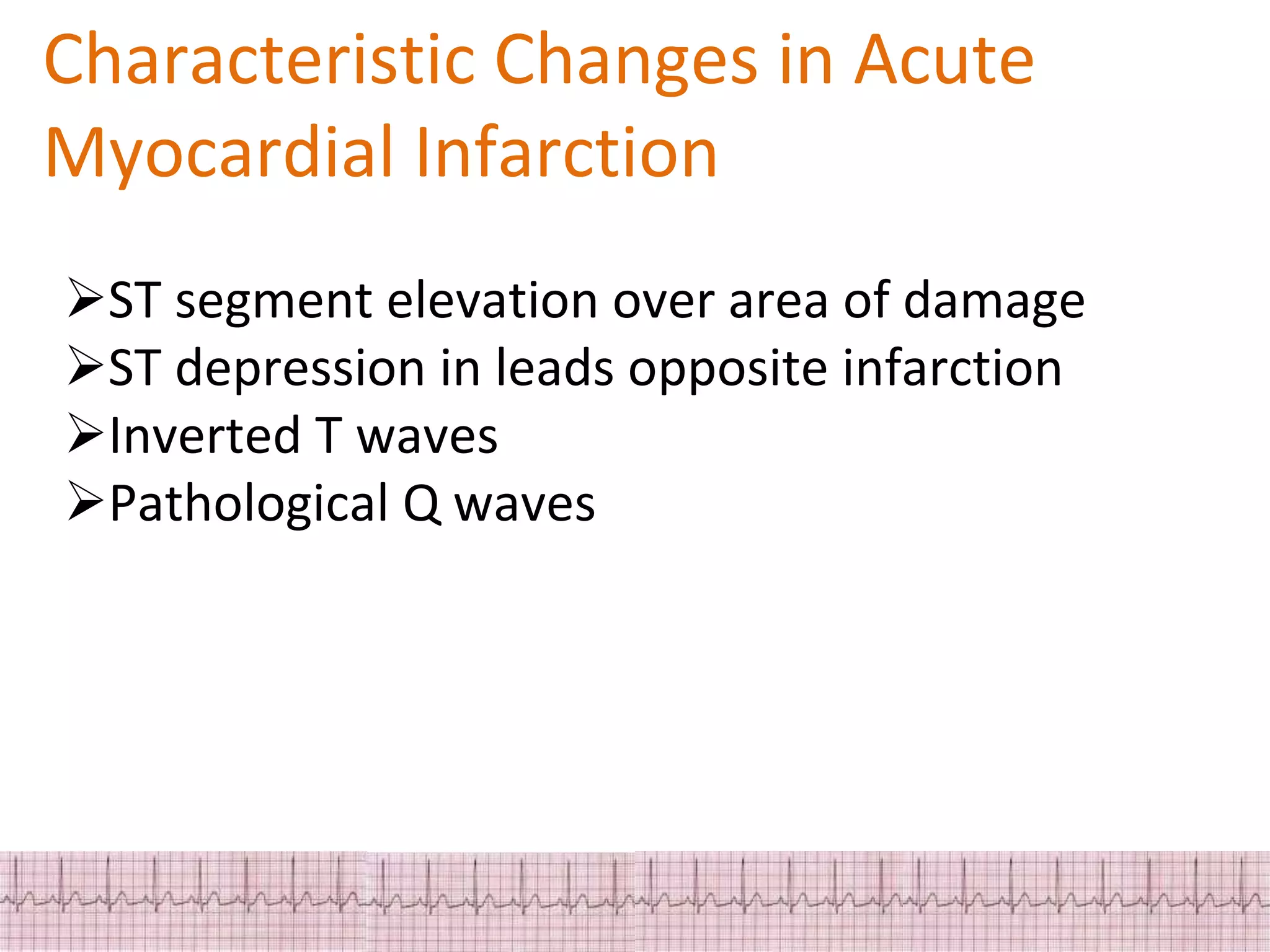 ECG Changes in Myocardial ischemia, myocardial infarction.pptx