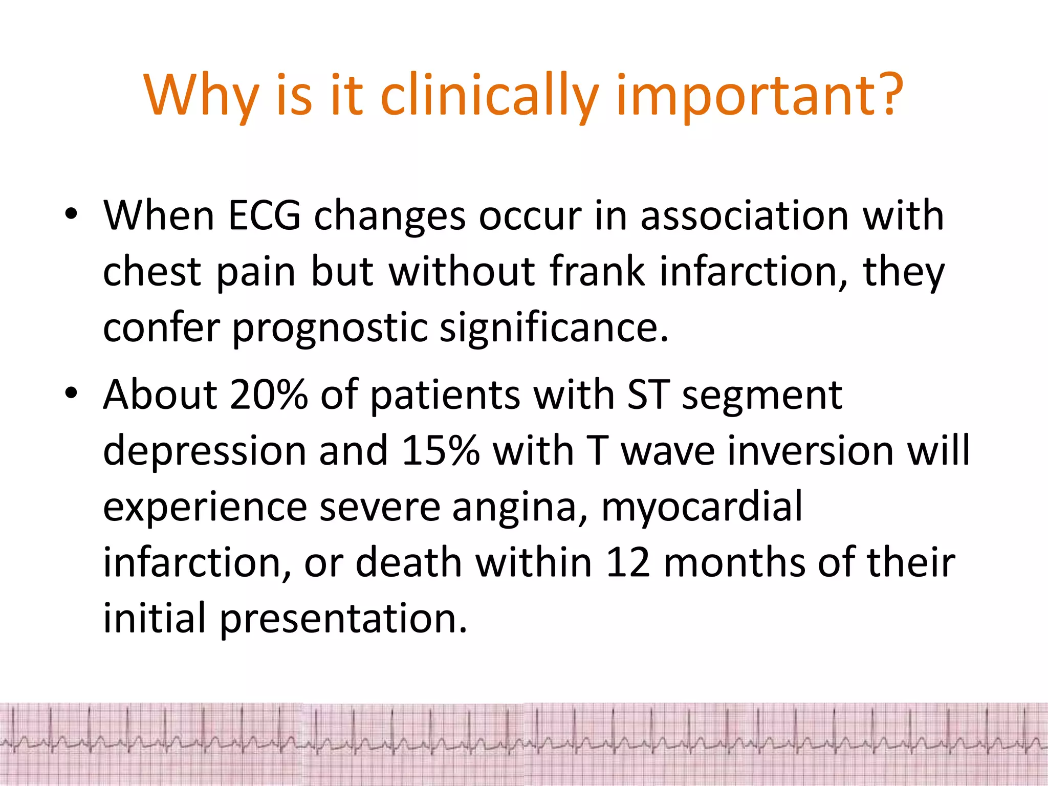 ECG Changes in Myocardial ischemia, myocardial infarction.pptx