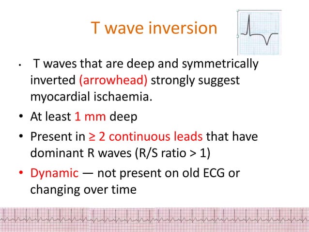 ECG Changes in Myocardial ischemia, myocardial infarction.pptx