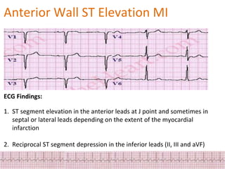 ECG Changes in Myocardial ischemia, myocardial infarction.pptx
