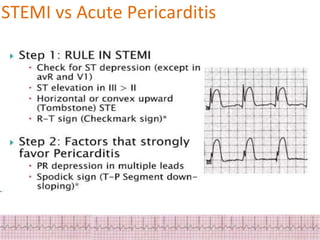 ECG Changes in Myocardial ischemia, myocardial infarction.pptx