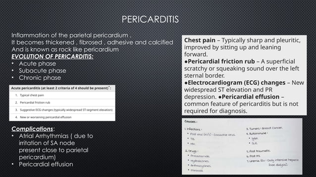 ecg changes in pericarditis and pleural effusion - Priyanshi Rastogi ...