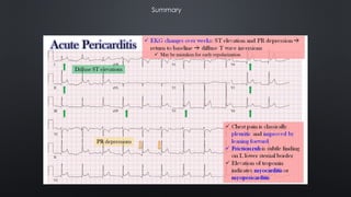 ecg changes in pericarditis and pleural effusion - Priyanshi Rastogi ...