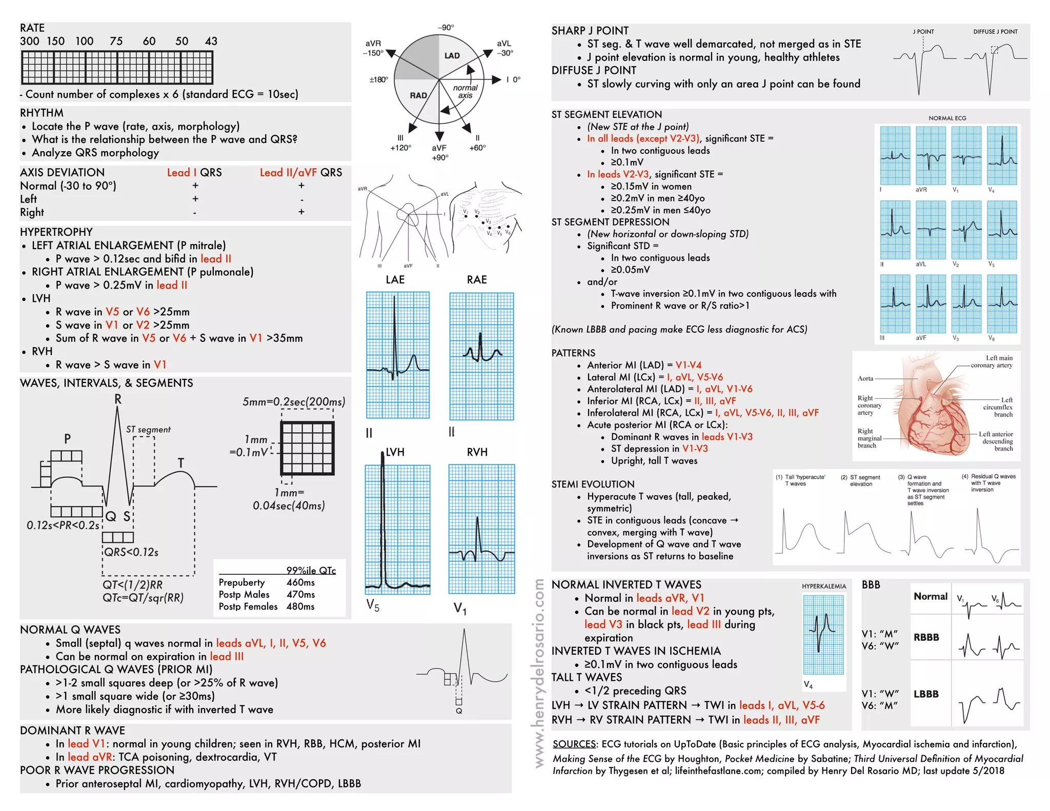 ECGcheatsheet52.pdf