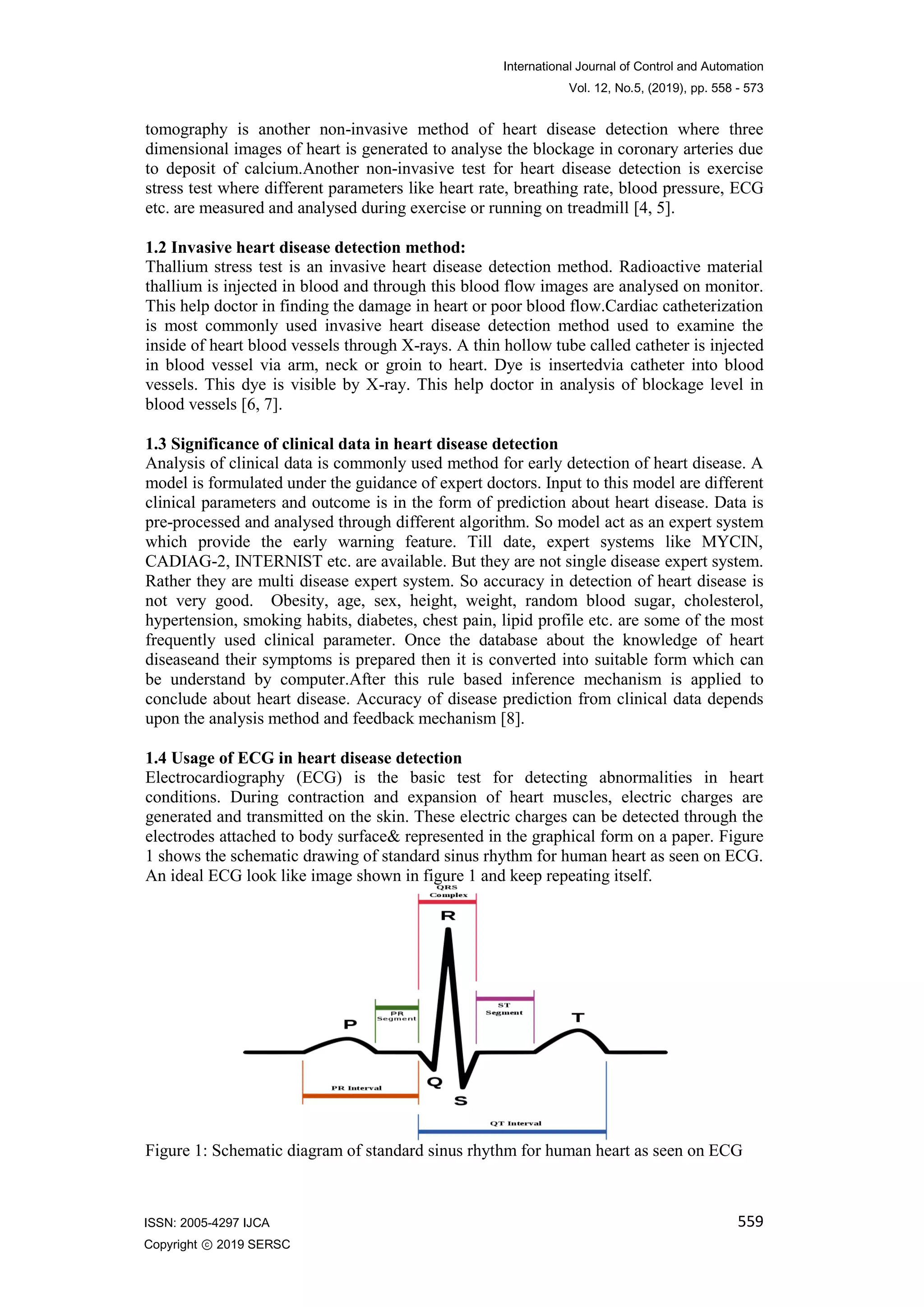 Ecg classification | PDF