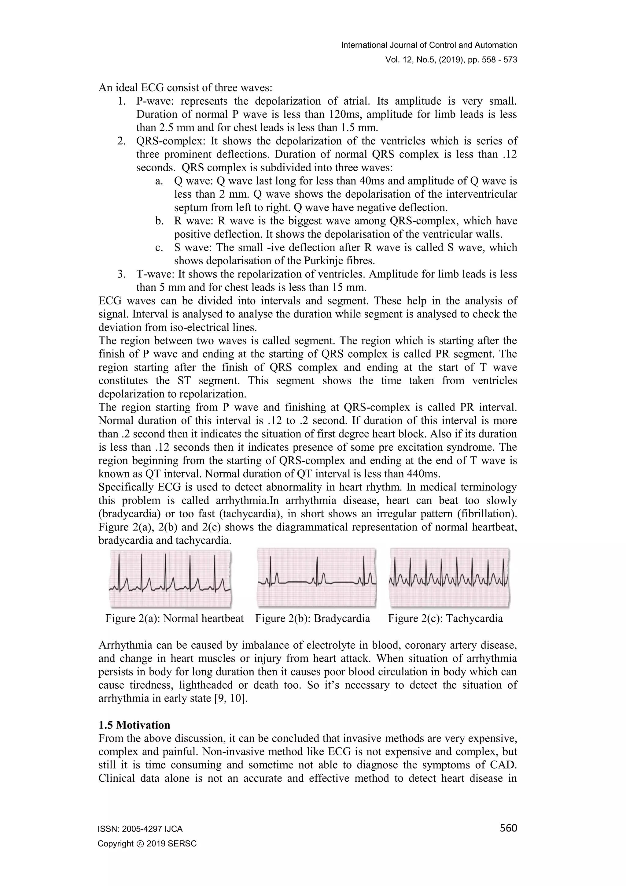 Ecg classification | PDF