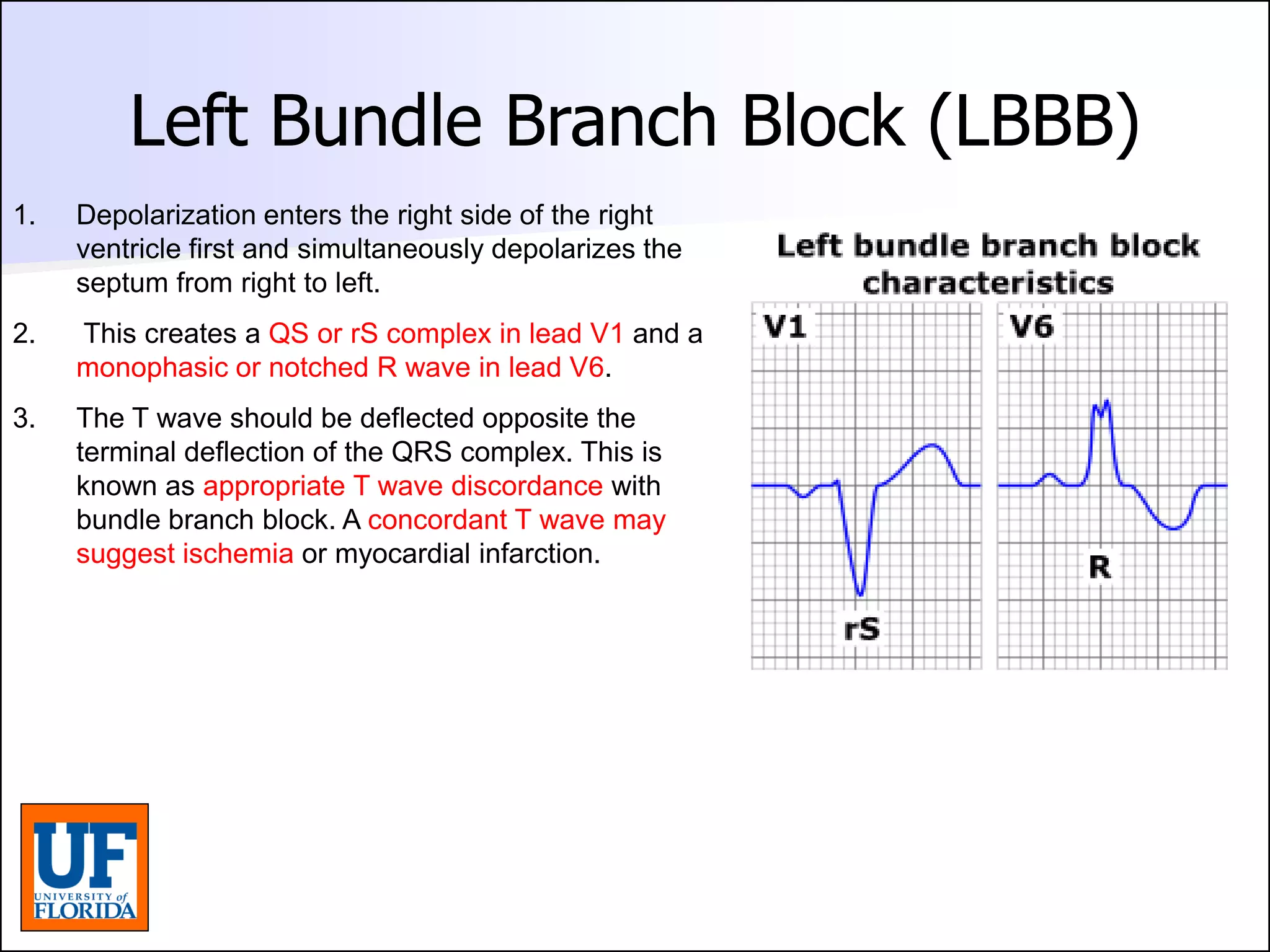 ECG [Compatibility Mode].pdf