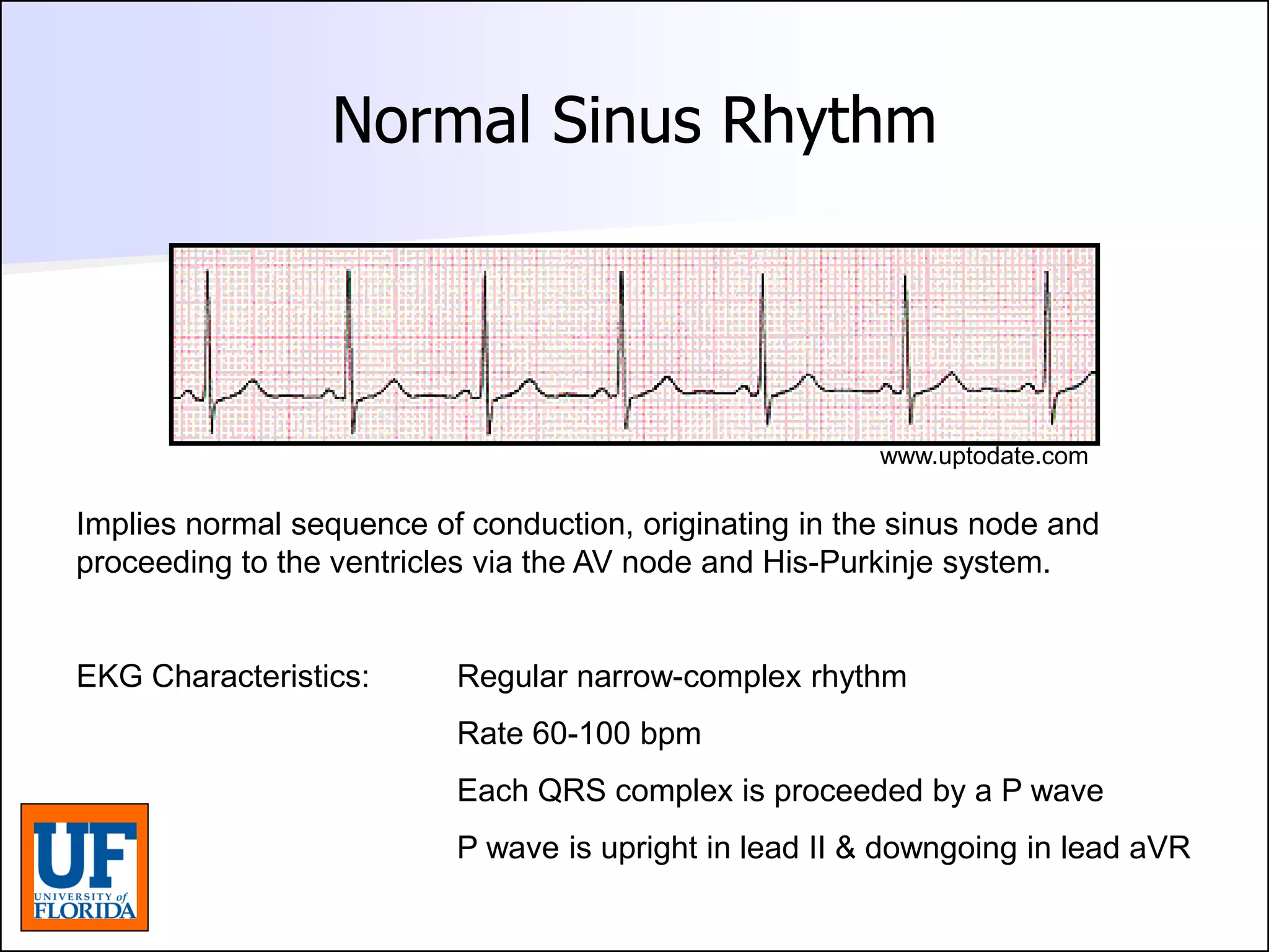 ECG [Compatibility Mode].pdf