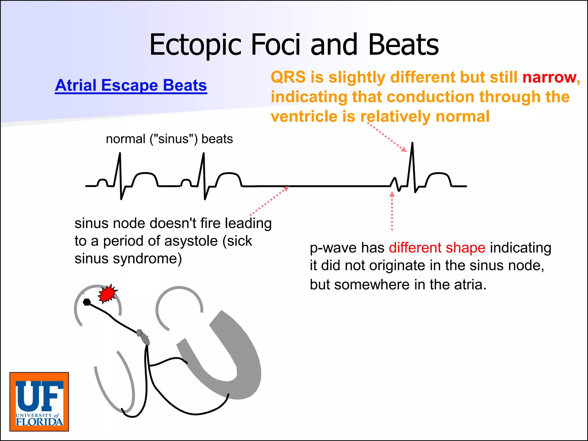 ECG [Compatibility Mode].pdf