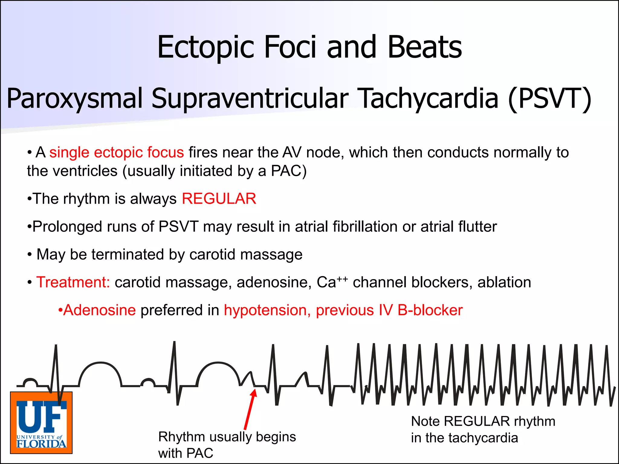 ECG [Compatibility Mode].pdf
